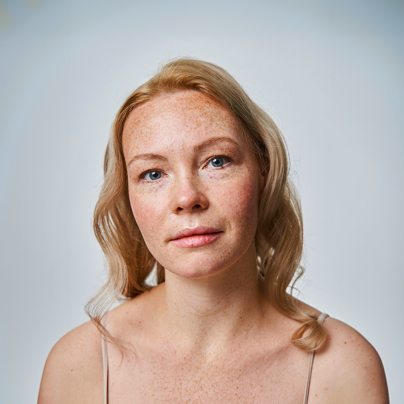 Facial Cupping Benefits: What is Facial Cupping Good For?
